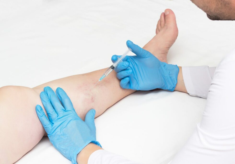Nationally Recognized Vein Doctor | Blue Veins vs. Green Veins ...